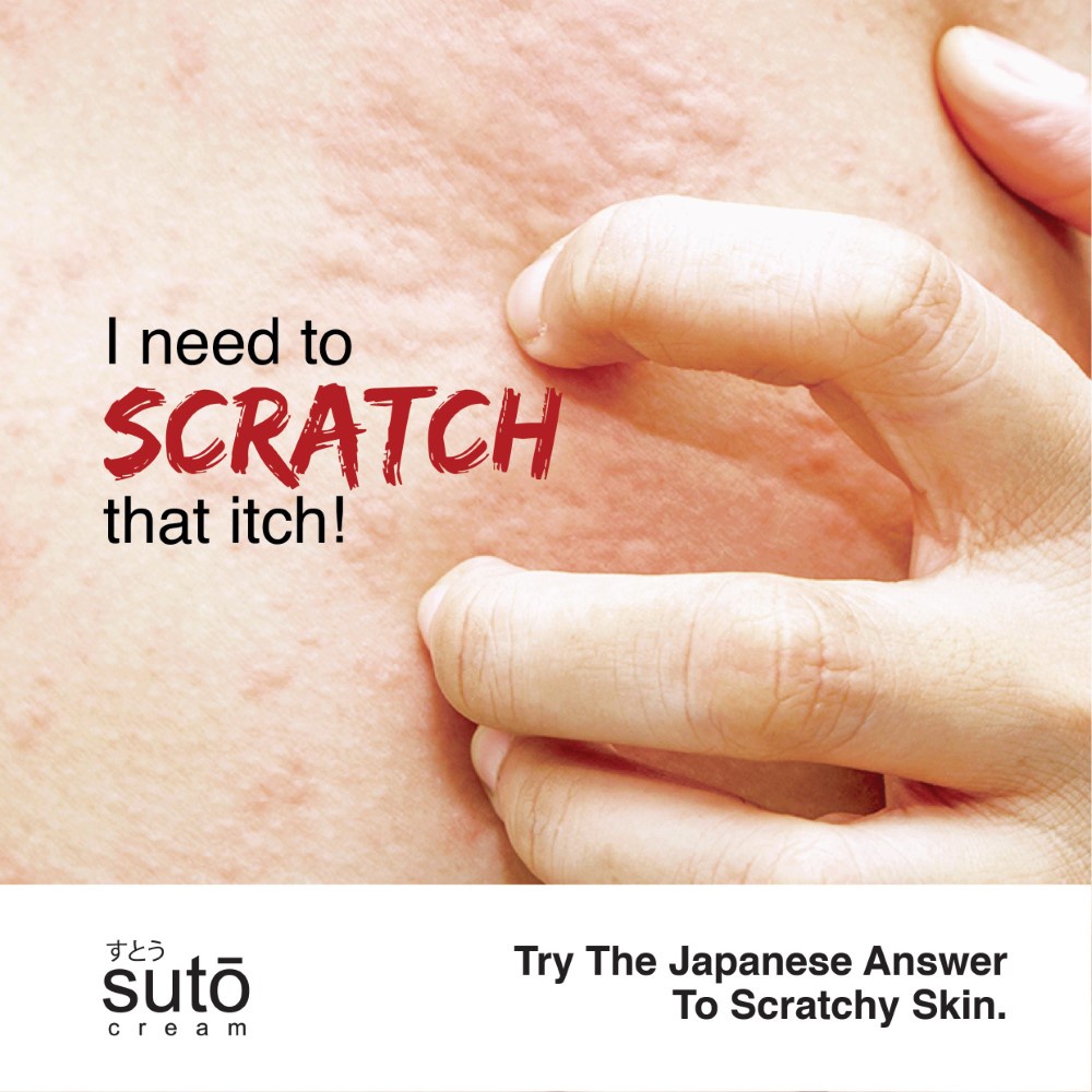 Alpro Pharmacy Exclusive - Suto Itch Relieving Cream 35g | Shopee Singapore