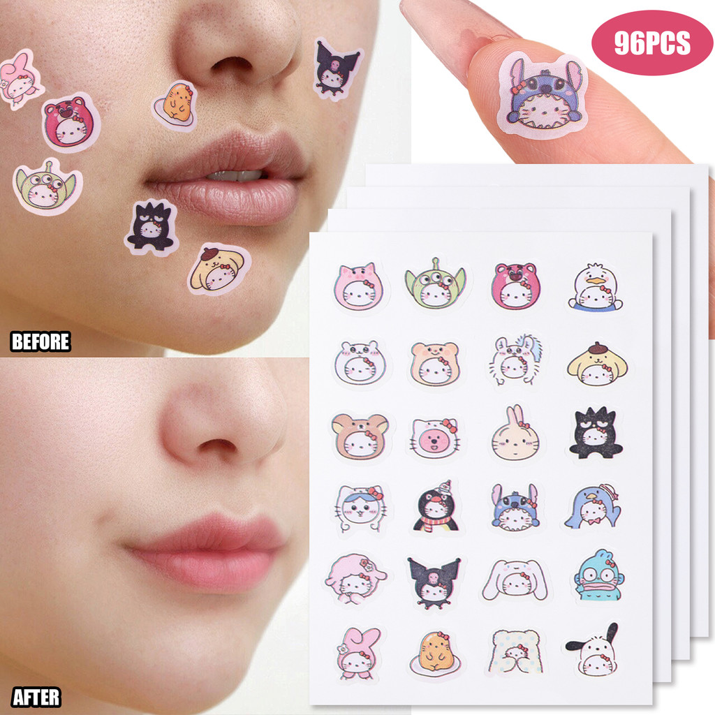 96Pcs/Pack Cute Cartoon Acne Patch - Ultra-thin Pimples Colorful ...