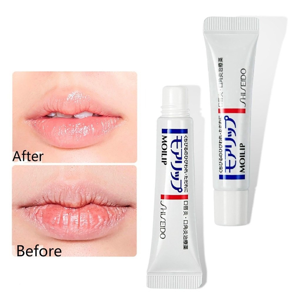 🔥Ready Stock in SG | Shiseido Moilip Medicated Vitamin E B6 Lip Cream ...