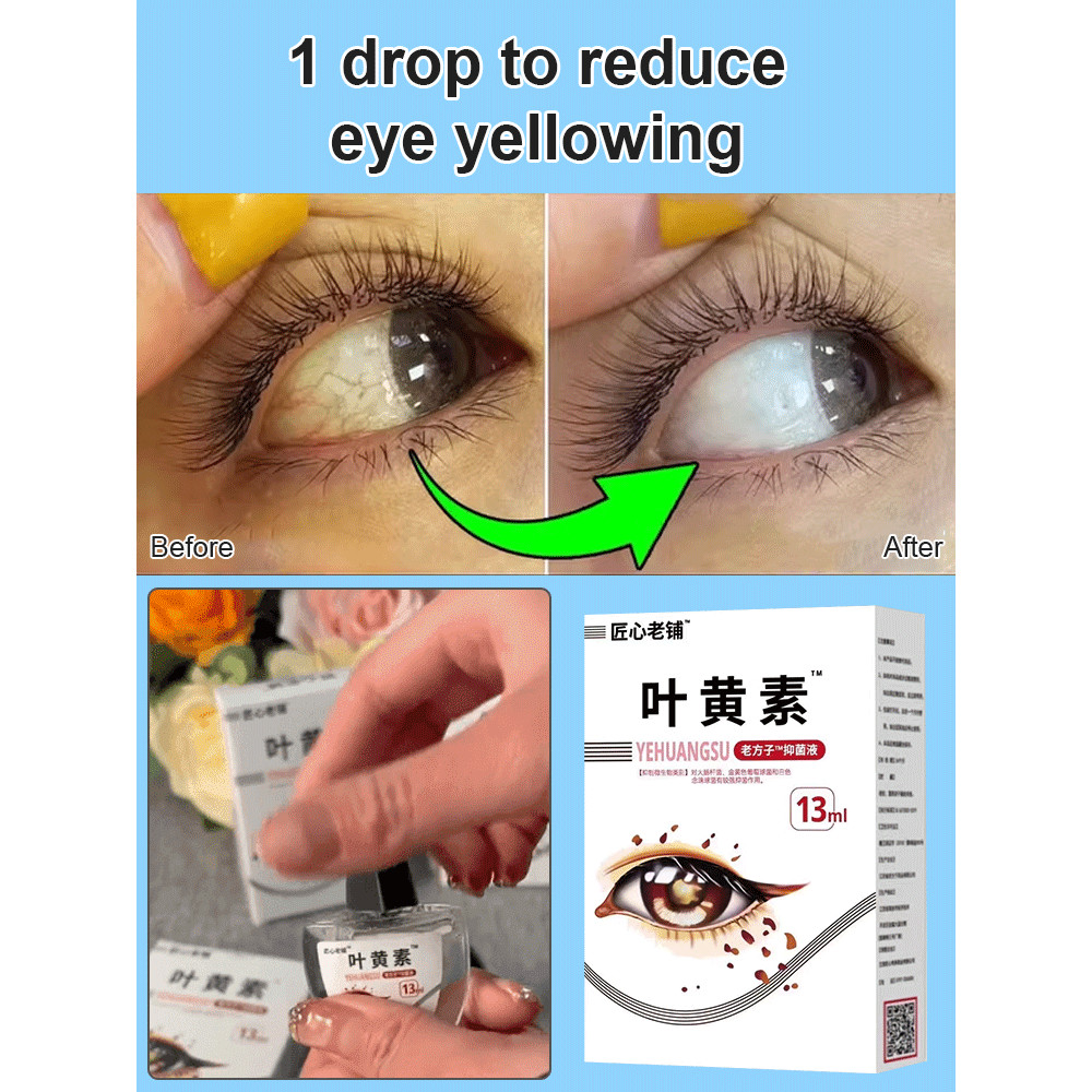 Dryness Eye liquid eye ointment Traditional craftsmanship Relieve eye ...