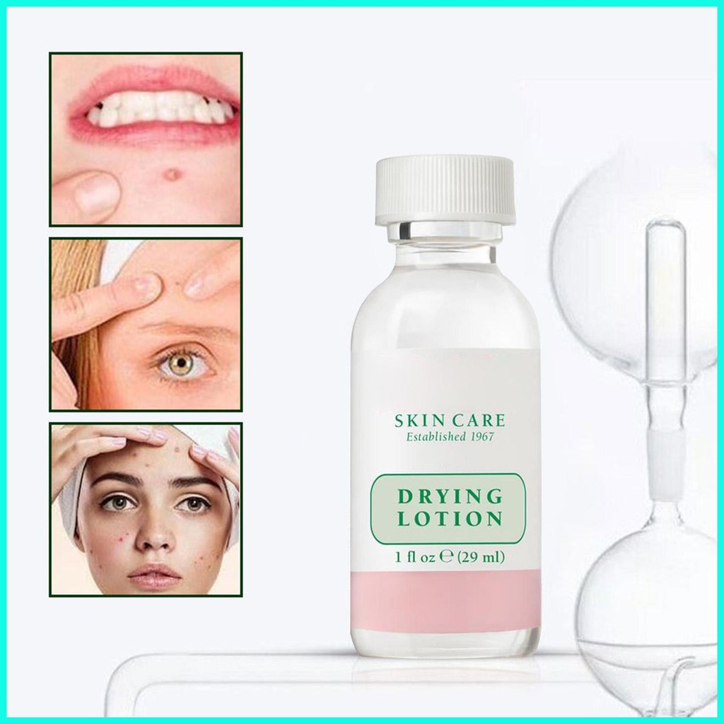 Pimple Drying Cream: Drying Lotion For Blemishes – ETDKHL