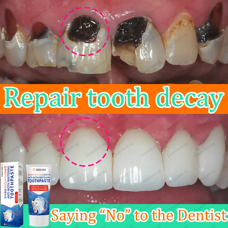 Japanese dentist anti-caries toothpaste containing fluoride ...