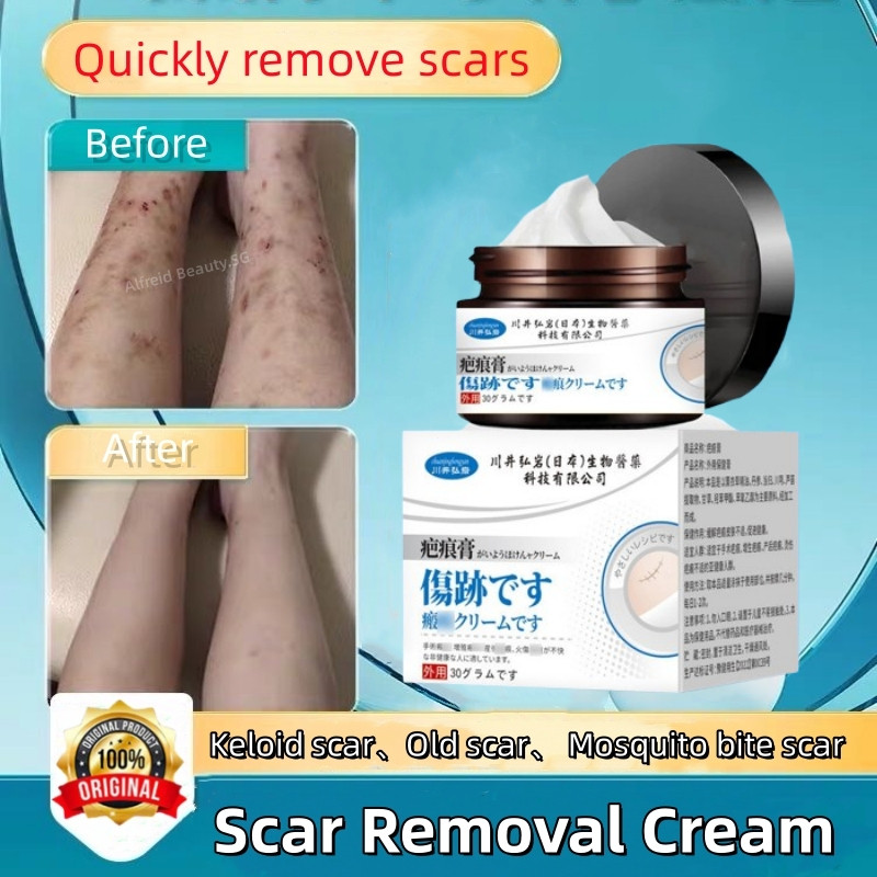 Japan Scar Removal Cream Keloid Scar Acne Scar Removal Mosquito Bite ...