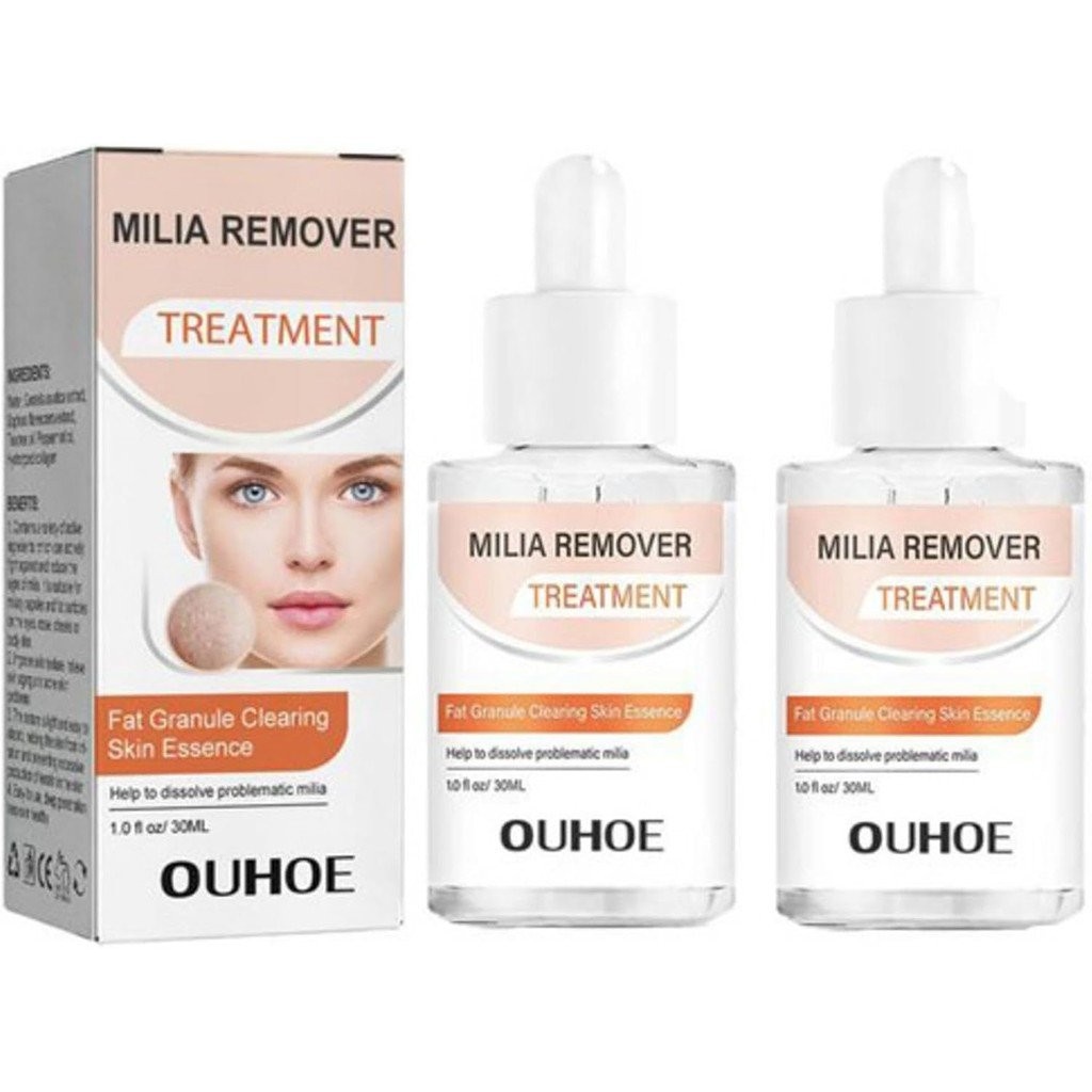 2 Milia Removal, 30ml Milia Removal Repair, Moisturizing Milia -ot ...
