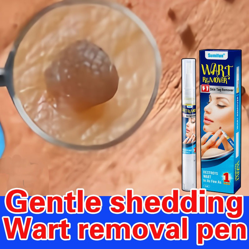 Mole remover wart removal liquid pen cure removal body papillomas ...