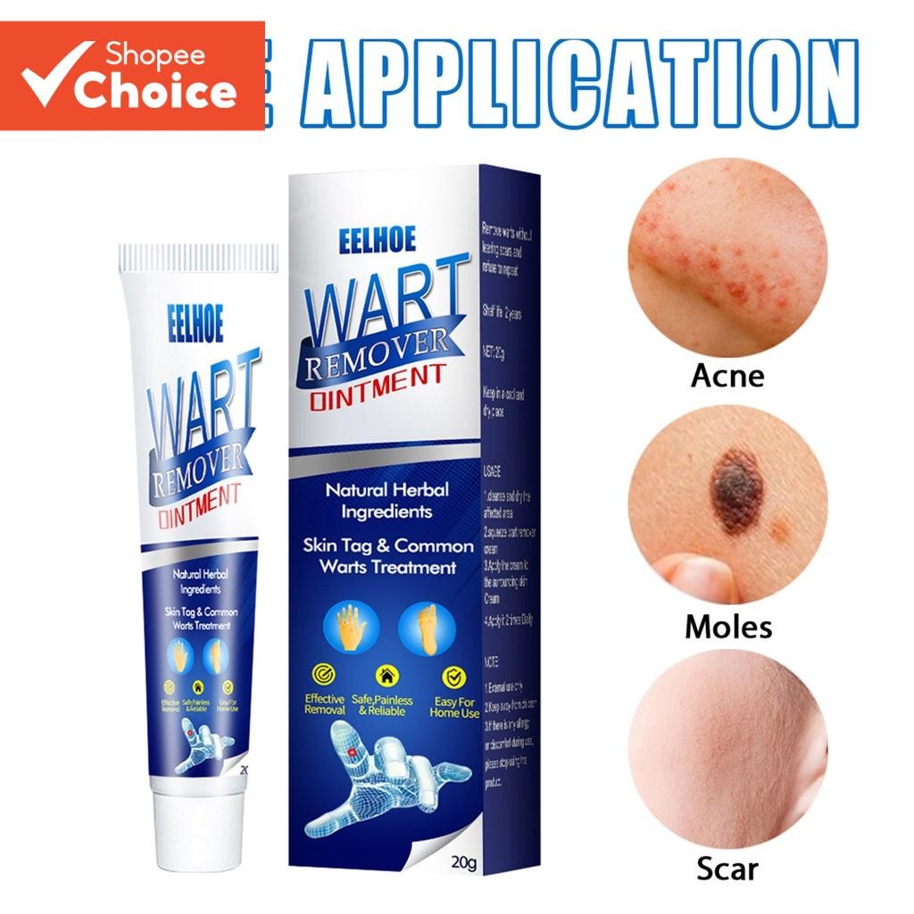 Skin Tags Remover Cream 20g Painless Mole Skin Dark Spot Warts Remover ...