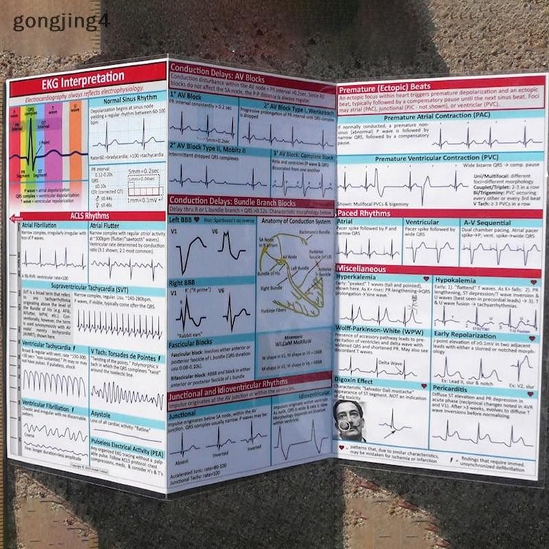 gongjing4 EKG Pocket Guide, EKG Rhythm Interpretation, Double Sidedpact Portable Reference Card ...