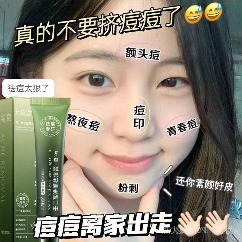 Acne cream Acne Removal Magic Tool Cream Anti-Acne Acne Acne Shrink ...