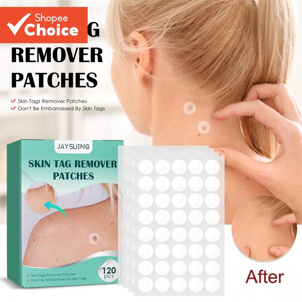 120 PCs/ box warts remover patch safe painless skin tags treatment wart ...