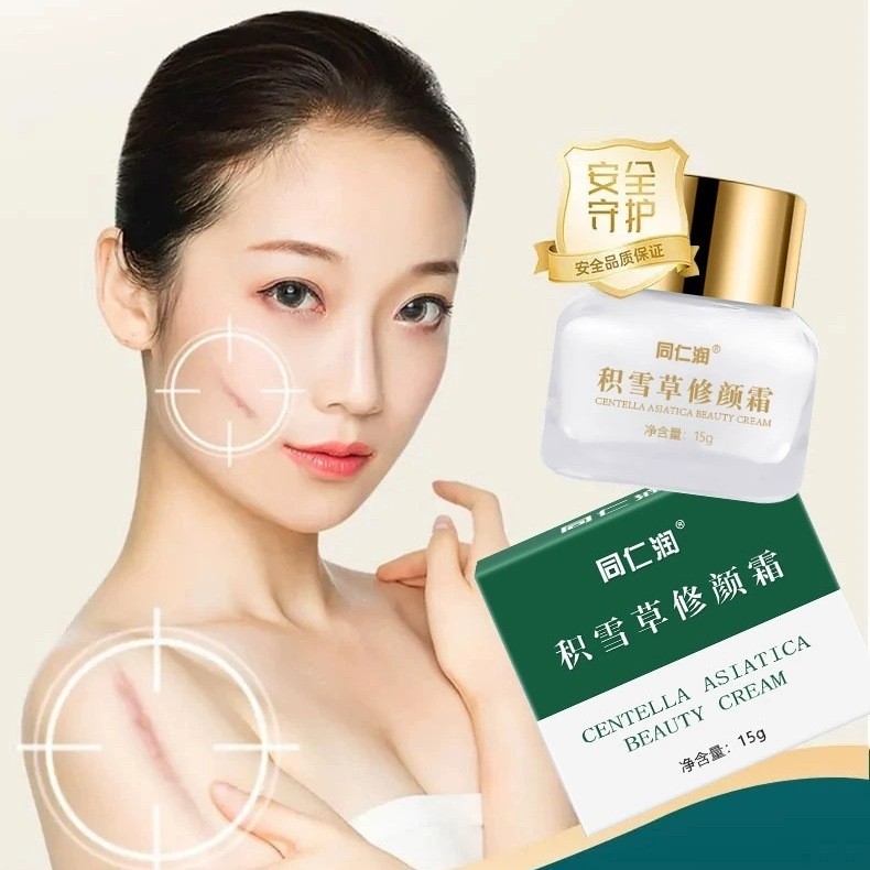 Spot Delivery in Seconds#Scar Gel for Removing Old Scars, Scar ...