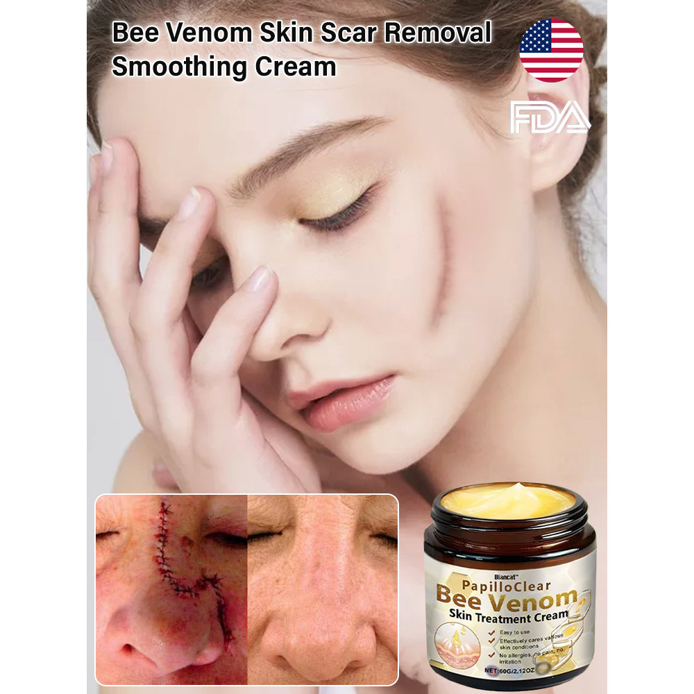 Lighten skin moles care cream Scar Removal Cream Improve skin condition ...