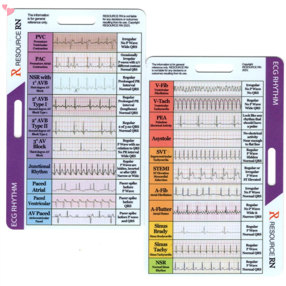 EKG Rhythm Interpretation - Compact & Portable Reference Card – Rapid ...
