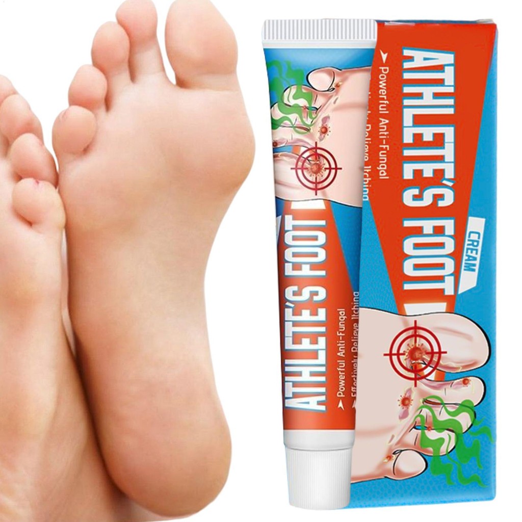 Anti Fungal Infections Foot Cream 20g For Athlete's Foot Pain Relief ...