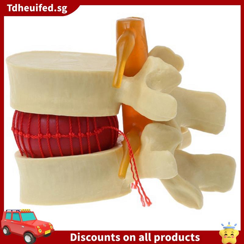 Lumbar Vertebrae Model Anatomical Spine Lumbar Disc Herniation Anatomy ...