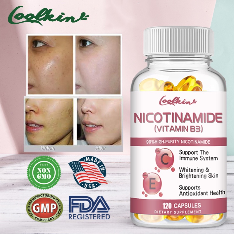 VB3 Niacinamide Whitening Capsules - Contains Vitamins C and E ...
