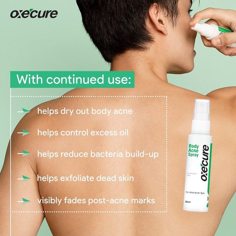 OXECURE 2% Salicylic Acid Body Acne Spray 25ml | Shopee Singapore