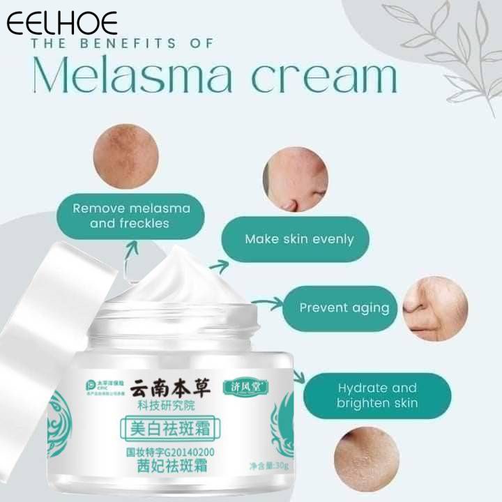 1/2pc Effective Japanese Melasma Cream White Spot Cream Skin Care Face ...