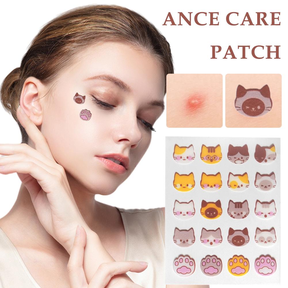 Cute Cat Acne Pimple Patch Remove Pimples Whiteheads Acne Treatment ...