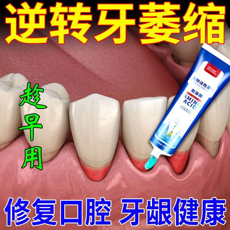 Gingival recession grow loose teeth root exposure protection of gum ...