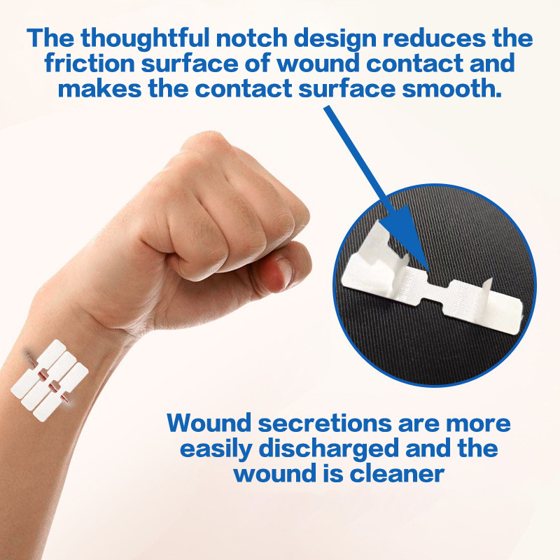 [eetmo] 10Pcs Zipper Band-aid Painless Wound Closure Device Suture-free ...