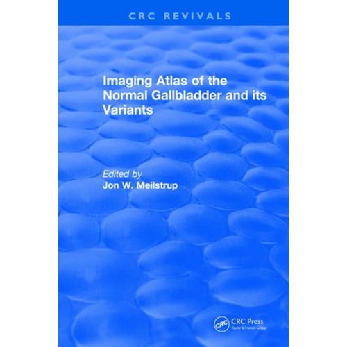 Imaging Atlas Of The Normal Gallbladder And Its Variants Of The Normal ...