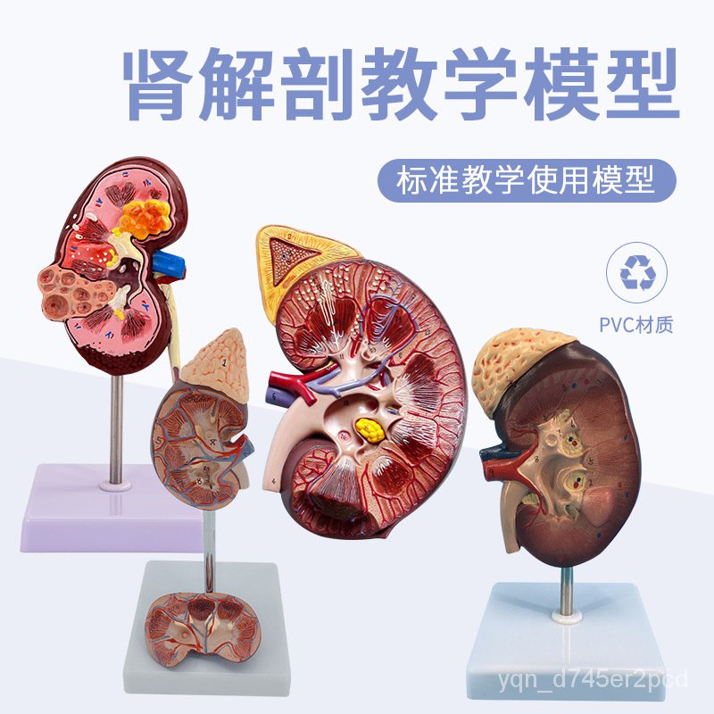KY-# Human Kidney Model Renal Anatomy with Adrenal Enlargement Model ...