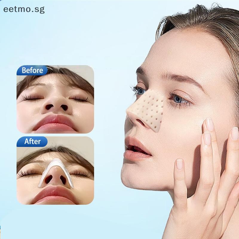 [eetmo] Low Temperature Thermoplastic Nose Splint Nose Job Rhinoplasty ...