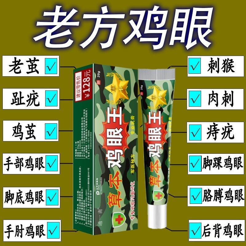 Cocoon King Foot Cocoon Calluses Hand Foot Thick Cocoon Hard Skin Corn ...