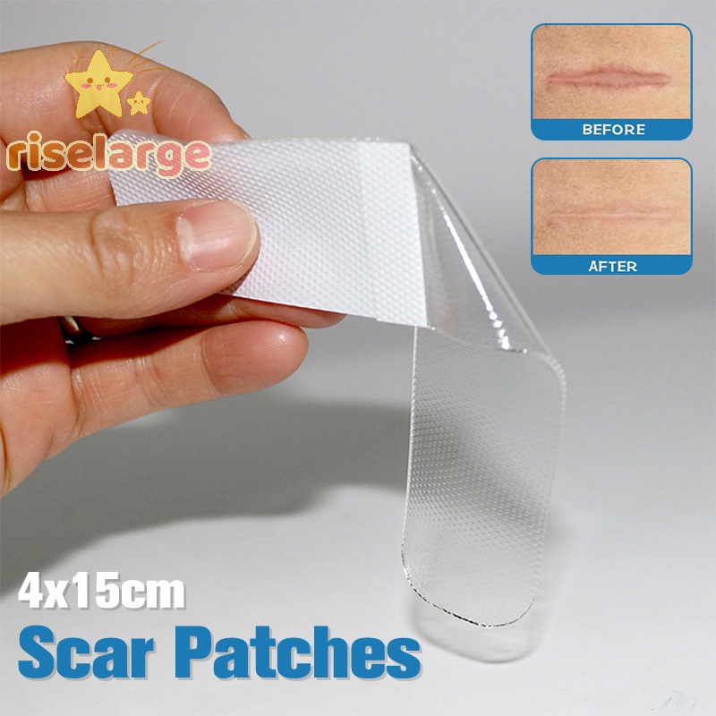 [RiseLargeS] 4x15cm Scar Patches Remove Silicone Gel Sheet Treatment ...