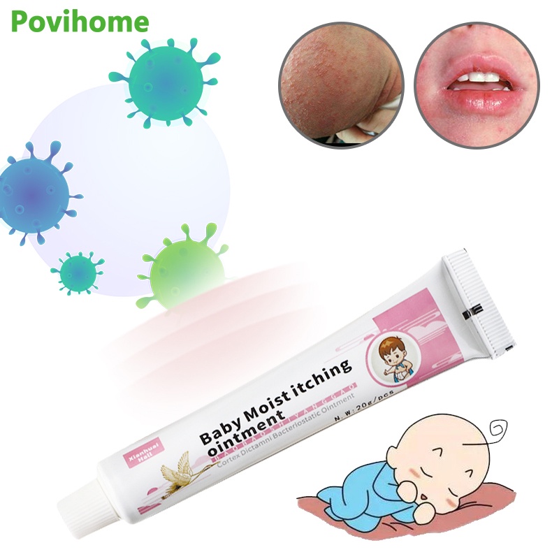 Baby Care Anti-bacterial Cream Soothes Eczema Pruritus Dermatitis ...