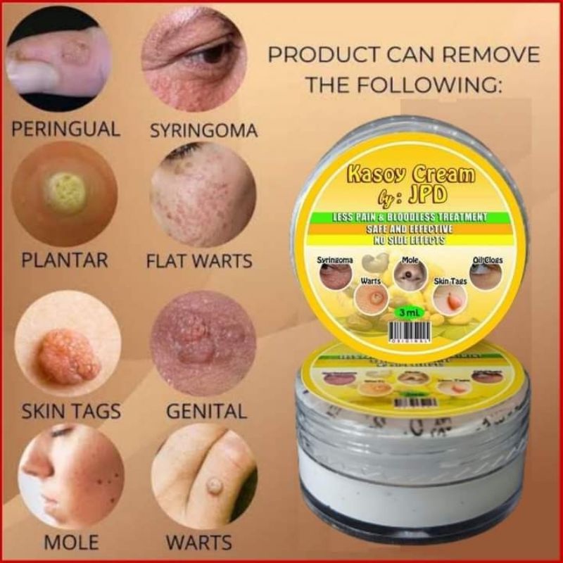 Kasoy Skin Tag Remover, Fast-Acting Skin Wart Removal, Easy To Use Skin ...