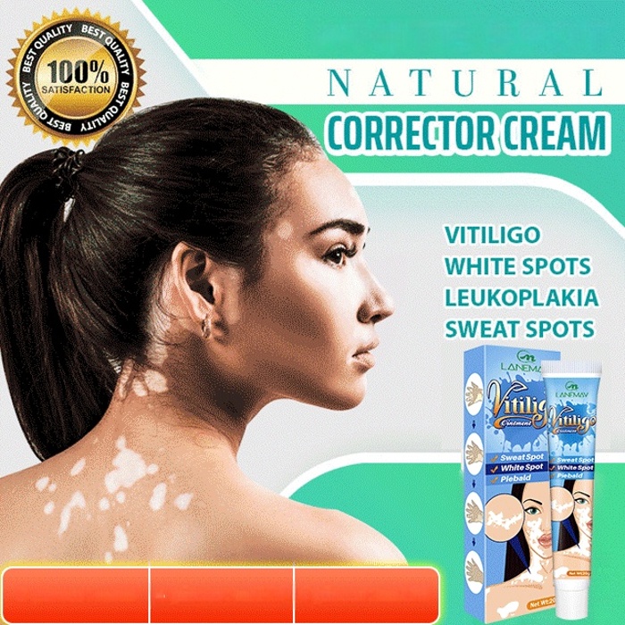 Topical cream for sweat spots and white spots and florid skin Spot Care ...