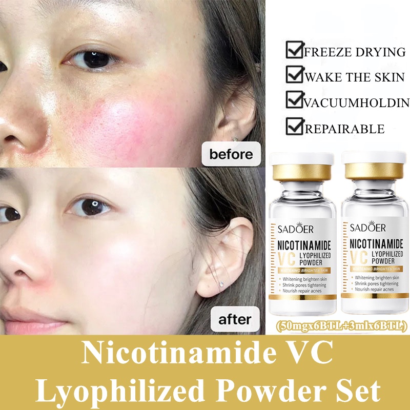 SADOER Nicotinamide Vc Lyophilized Powder Set 12pcs Skin Sensitivity Repair Red Blood Filament ...