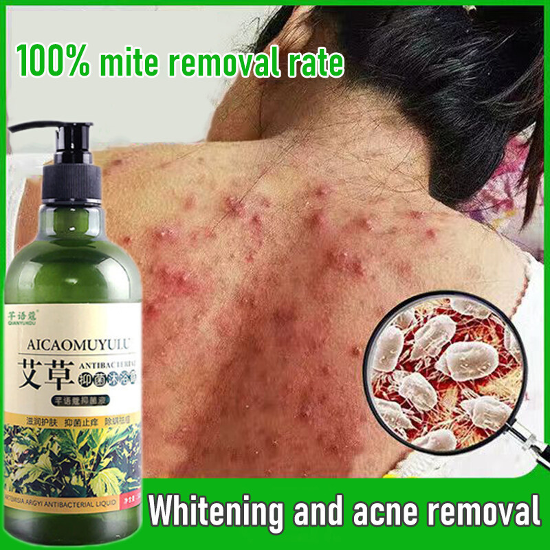 [SG SELLER]Acne Clear Body Wash 500ml Mugwort anti-mite and anti-itch shower gel Deep cleansing ...
