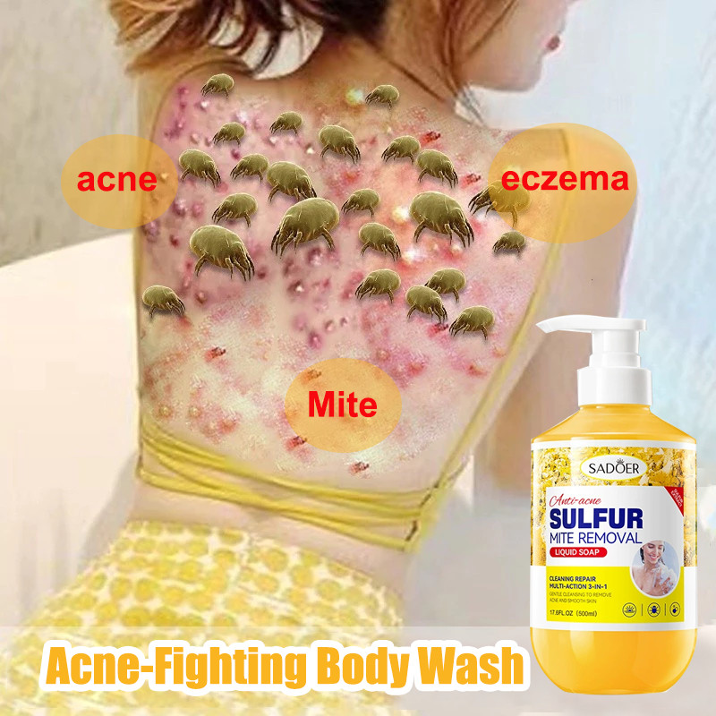 acne body wash Sabun /Acne Clear Body Wash 500ml Mugwort anti-mite and anti-itch shower gel Deep ...