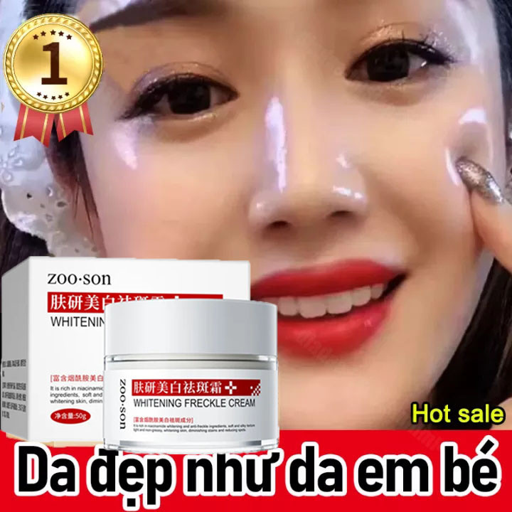 ZOO-SON Pekas Remover Effective Melasma Cream Anti Freckle Collagen ...