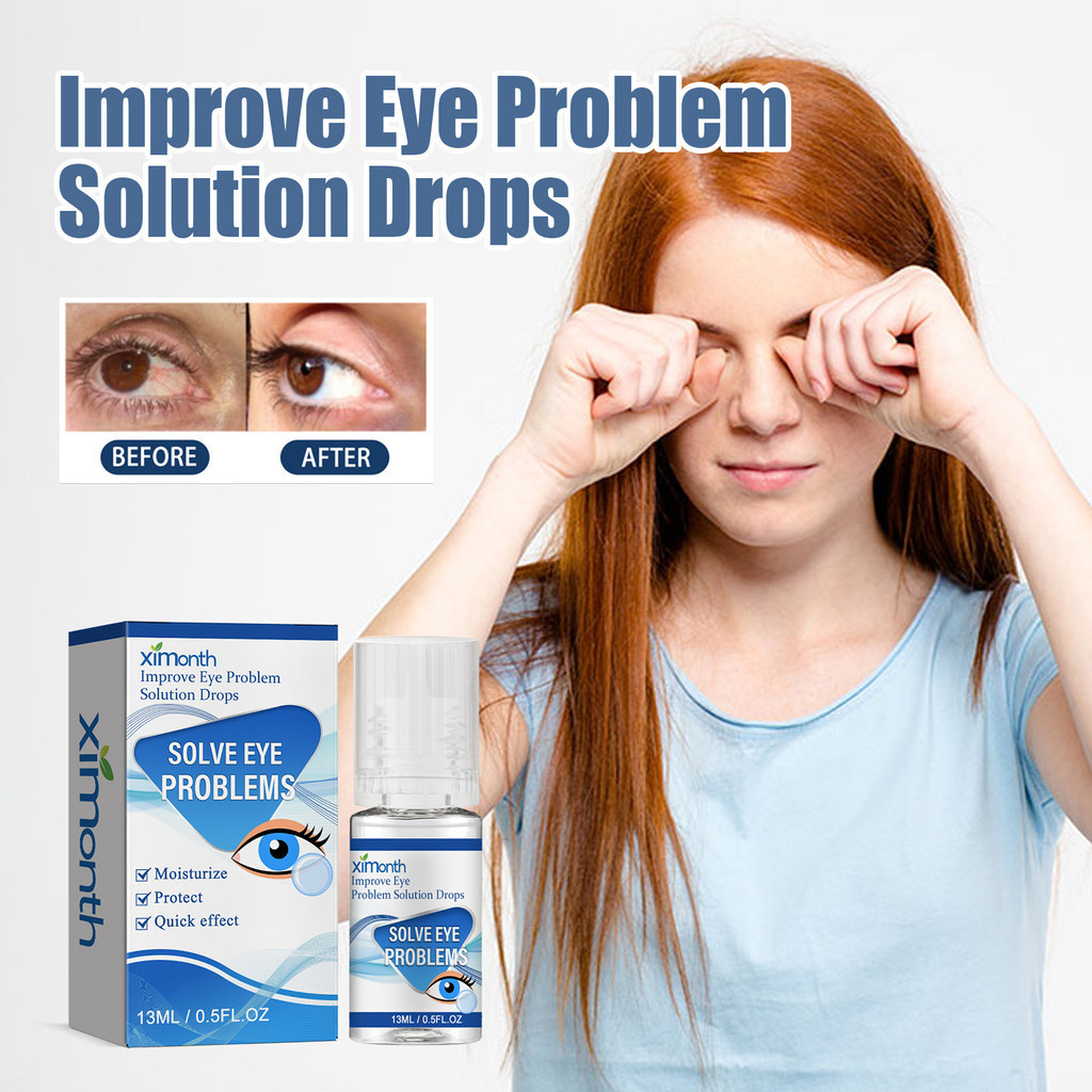 Myopia Eye Drops Relieve Eye Fatigue, Soreness, Redness and Swelling ...