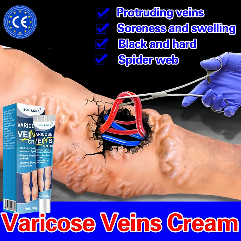 Varicose veins treatment cream Improve blood circulation treatment of ...