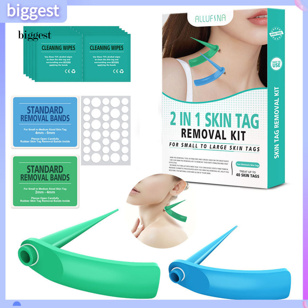 BGT Skin Tag Rubber Band Removal Skin Tag Removal Device Skin Tag ...
