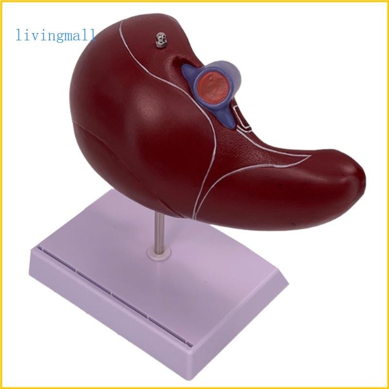 LIVI Anatomical Liver Model for Liver Disease Study Medical Lecture ...