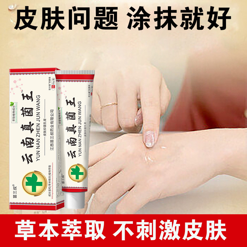 Yunnan Fungus King Itch Relief Cream Itchy and Peeling Hands and Feet Athlete's Foot Herbal Anti ...