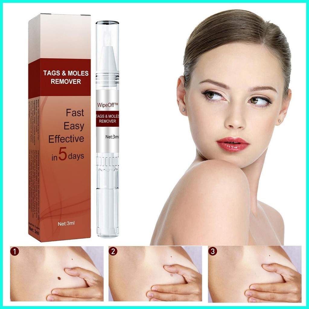 Skin Tag Remover Liquid Mole Removal Natural Non-Irritating Liquid ...