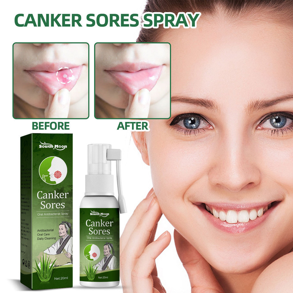 Oral Ulcer Relief Spray Canker Sore Swollen Gum Pharyngitis Relieve ...