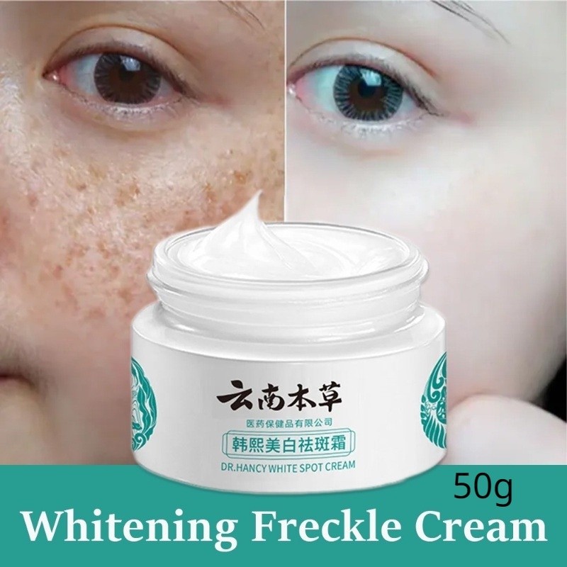 Yunnan Herbal Dark Spot Corrector Cream Whitening Freckle Cream Powerful Removing Melasma ...
