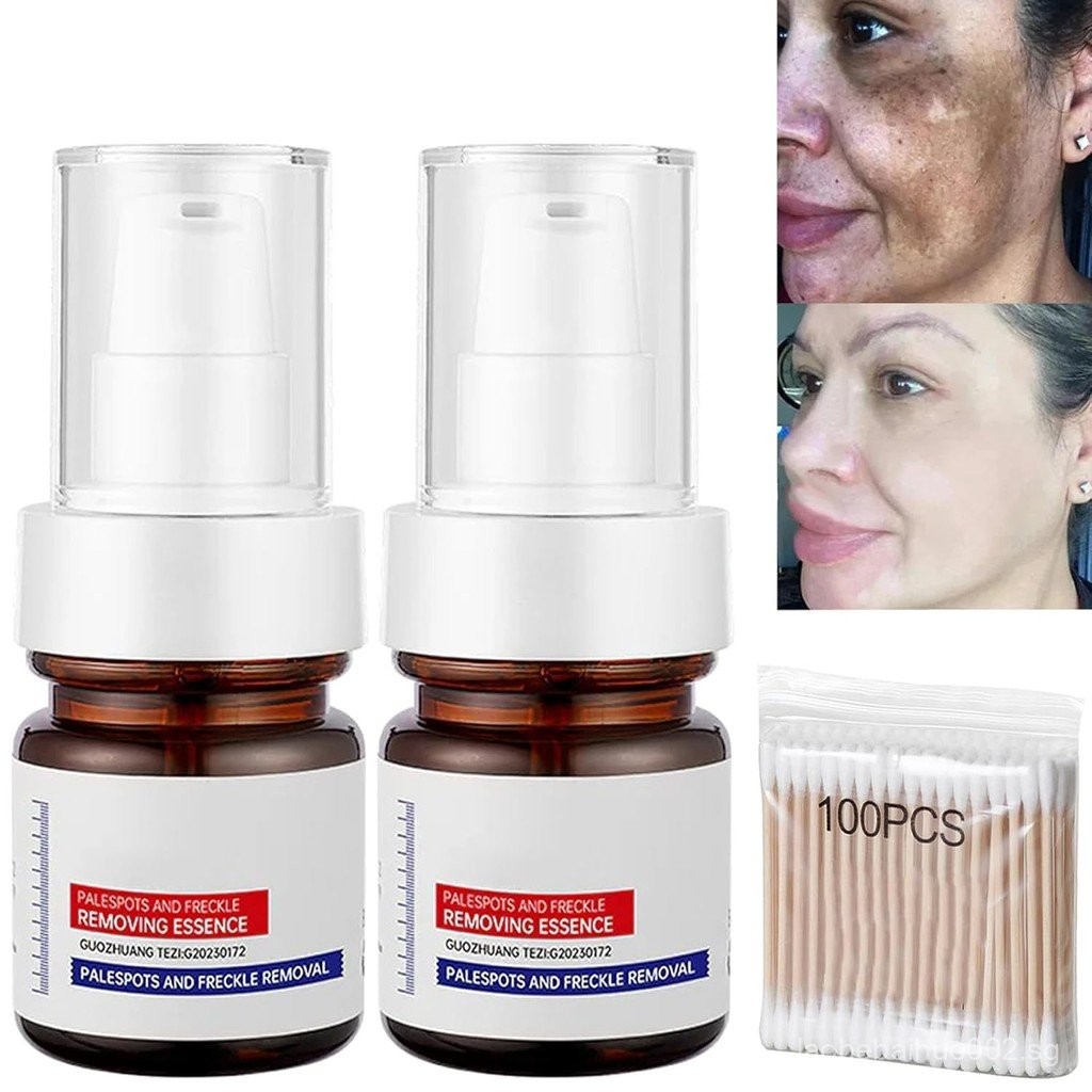 Aobenz Spot Remover for Face Vitamin C Face Cream 40 ml1.4 oz Serum for ...