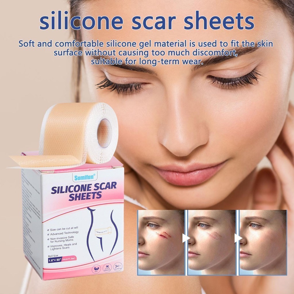 Scar Away Sheet Silicone Scar Strip Silicone Tape Roll Silicone Scar ...