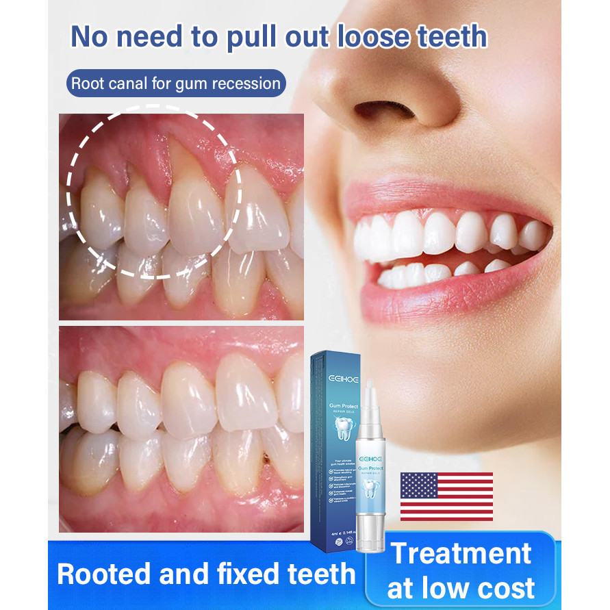 [No need to extract loose teeth] Teeth repair gel repairs gum swelling ...