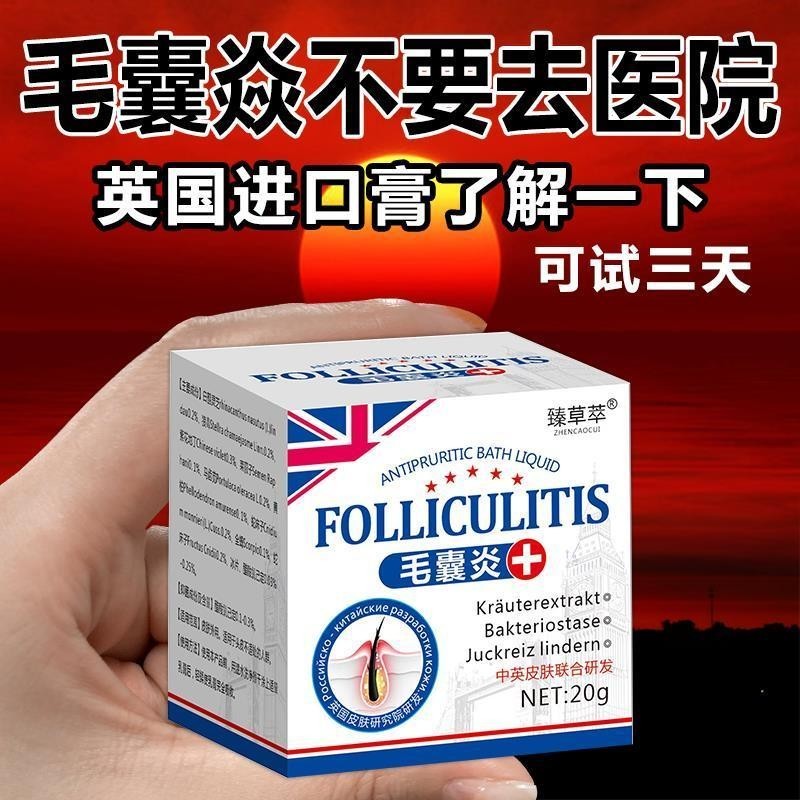 Scalp Folliculitis Cream Special Tinea Capitis Seborrheic Dermatitis ...