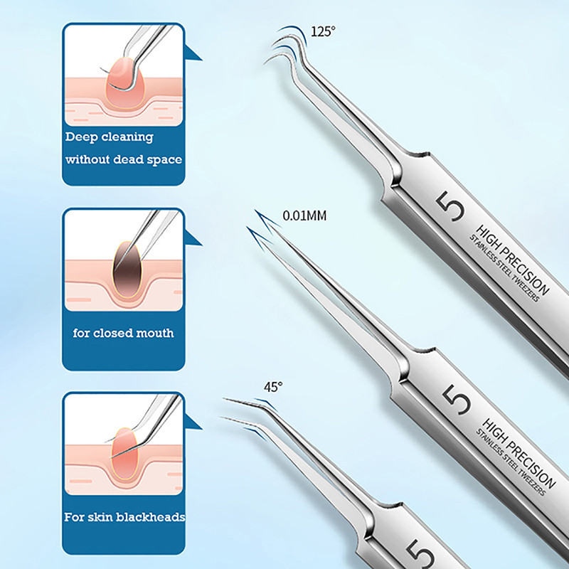 5-in-1 Stainless Steel Acne Clip set German Ultra-fine No. 5 Cell ...