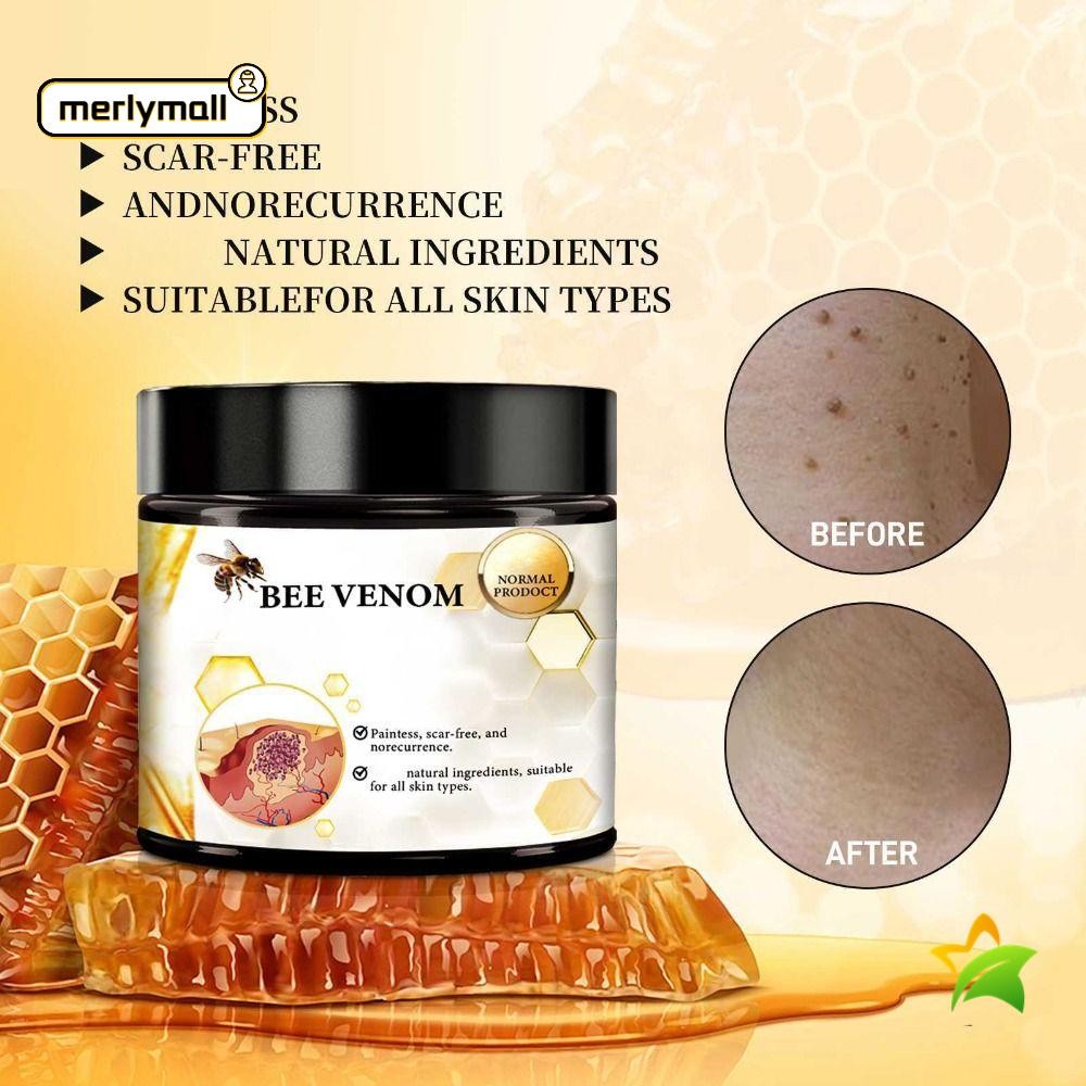 MERLYMALL Bee Venom Skin Treatment Cream, Bee Venom Fast-Acting Bee ...